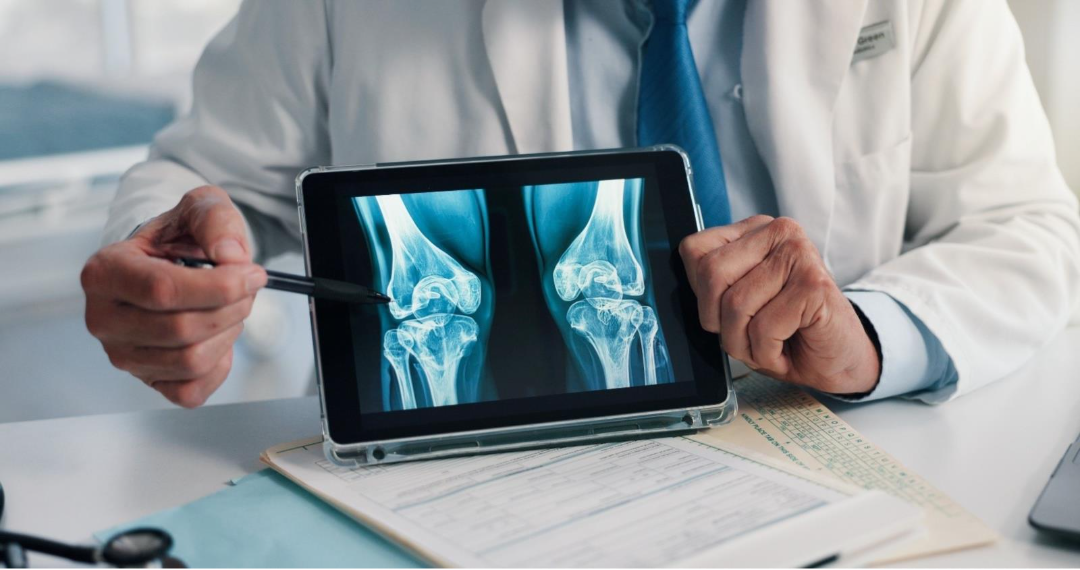 How Digital X-Ray Technology Improves Accuracy