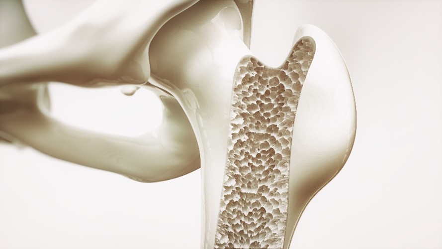 5 Things You Probably Don’t Know About Bone Density