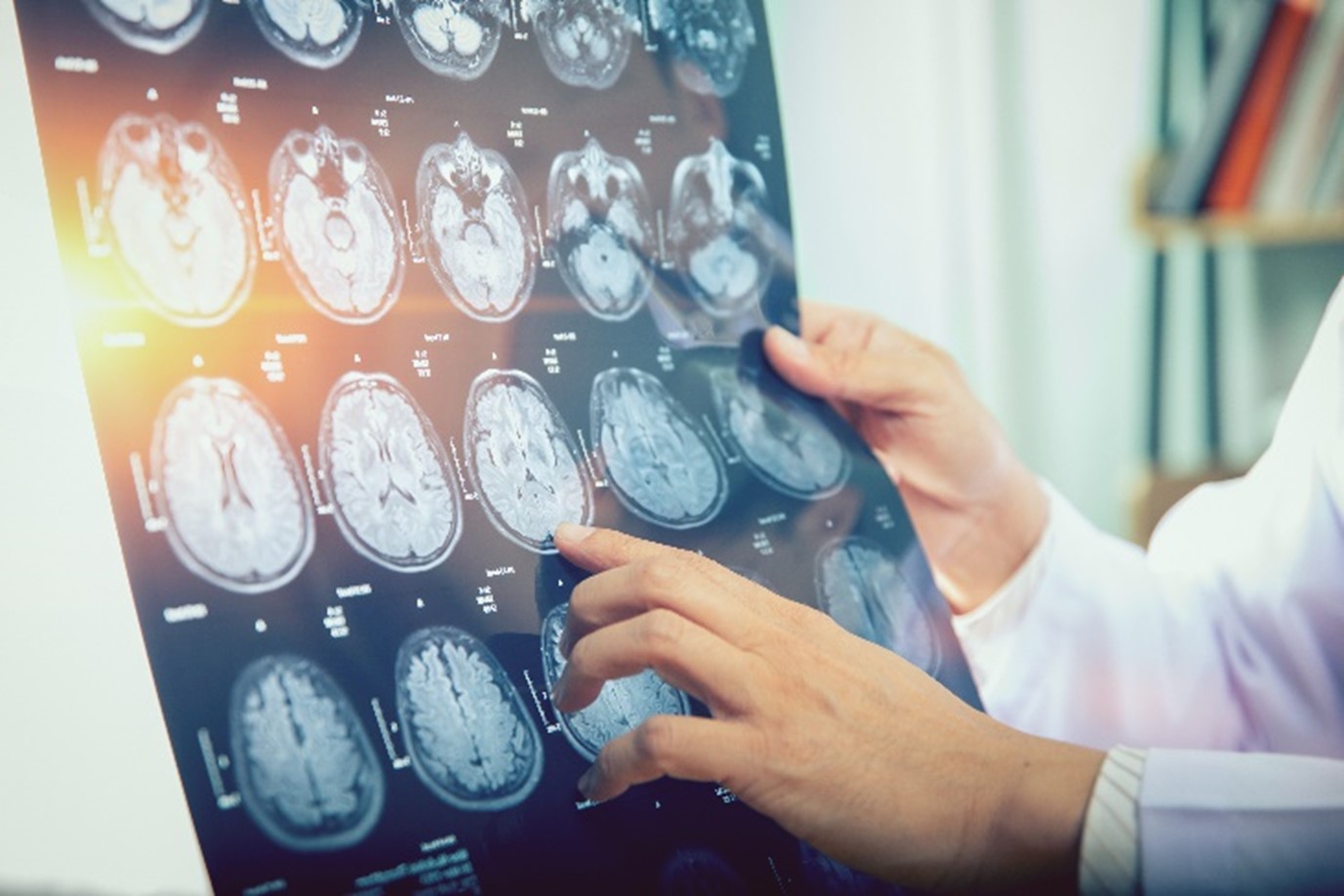 When You Should Get a Brain MRI | ImageCare Centers