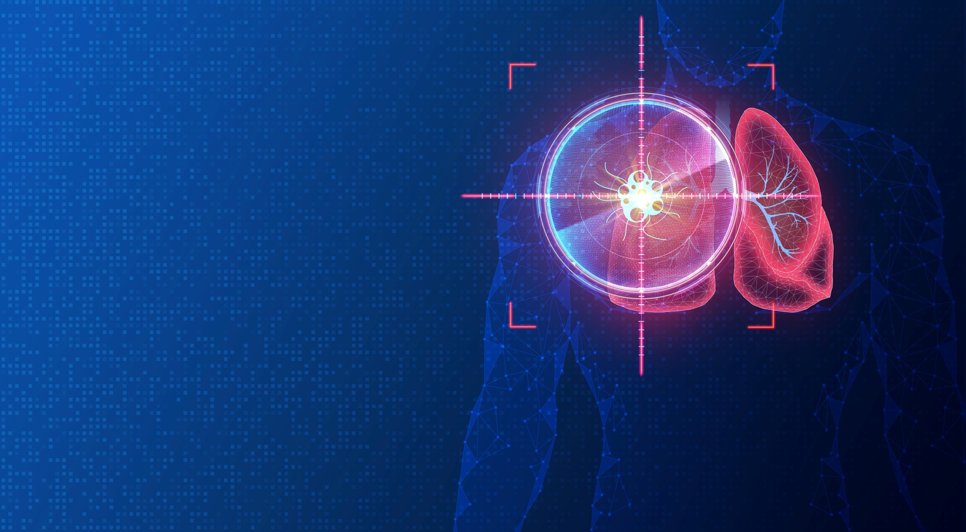 Interventional Oncology Treatments in New Jersey | ImageCare