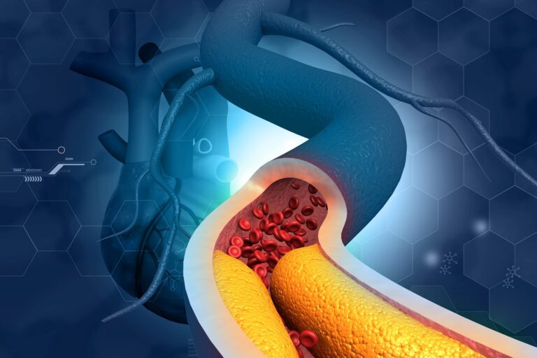 Arterial Disease Imaging in New Jerse | ImageCare Centers