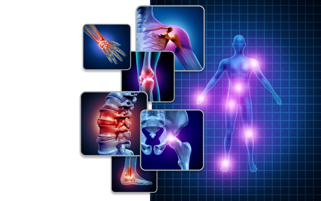 Advanced Arthrography Imaging | ImageCare Centers