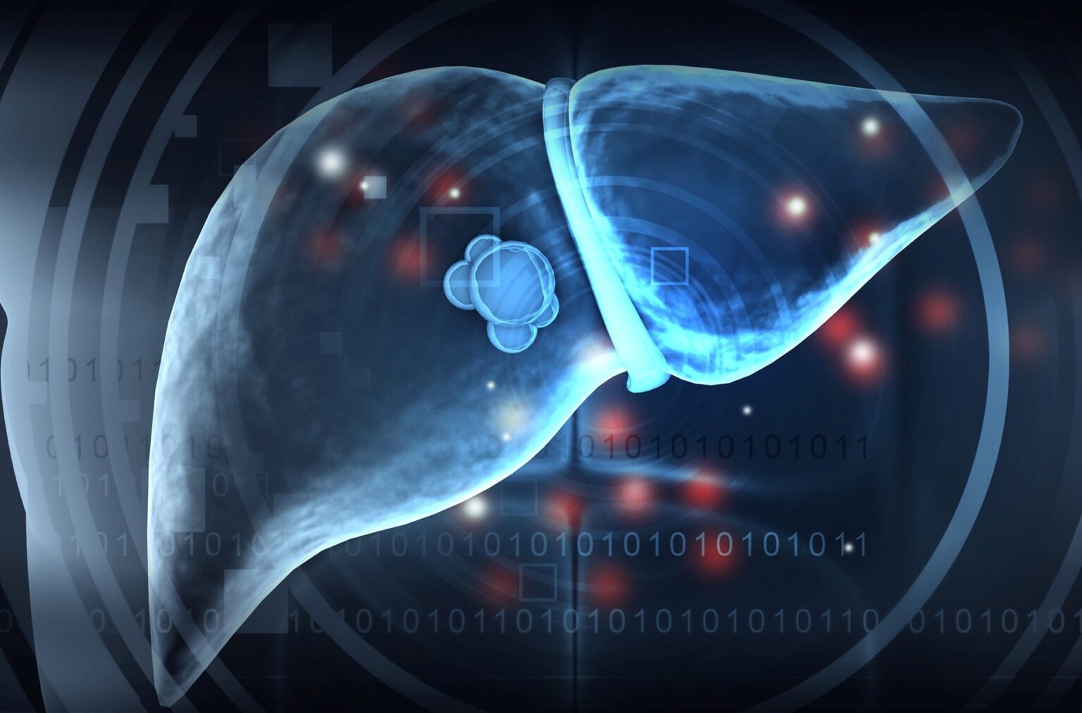 Bland Embolization | ImageCare Radiology