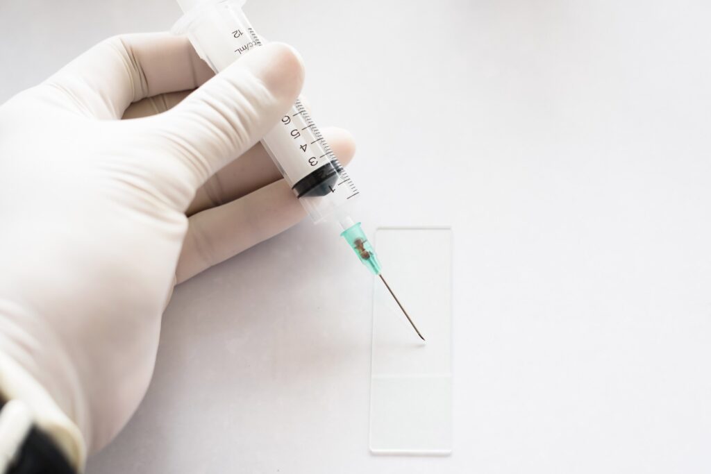 Cysts & Abscesses Treatment in New Jersey | ImageCare